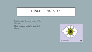 B scan ultrasonography | PPTX