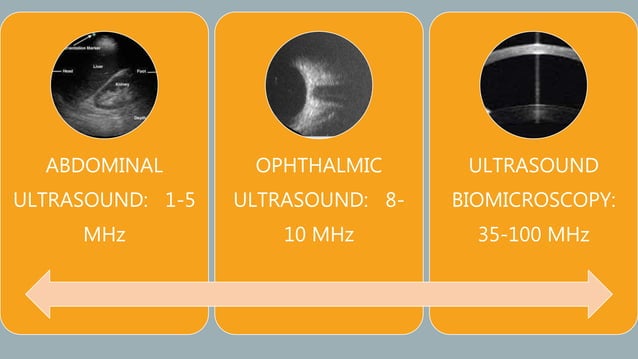 B scan ultrasonography | PPTX