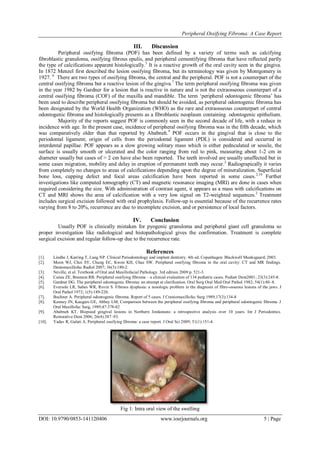 Peripheral Ossifying Fibroma: A Case Report | PDF