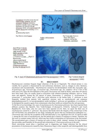 Two cases of Toenail Chaetomycosis from district Jammu (India). | PDF