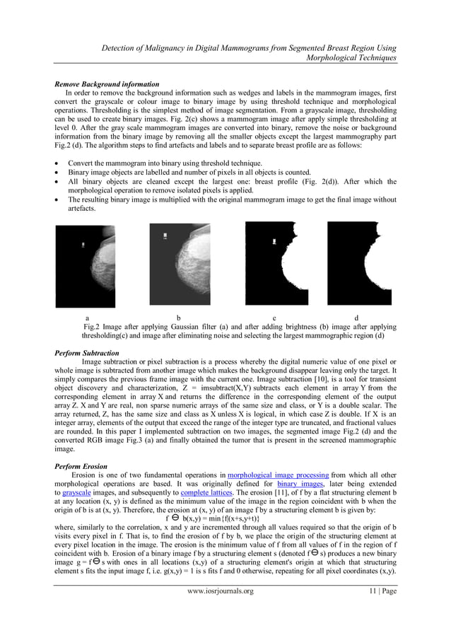 Detection Of Malignancy In Digital Mammograms From Segmented Breast Region Using Morphological