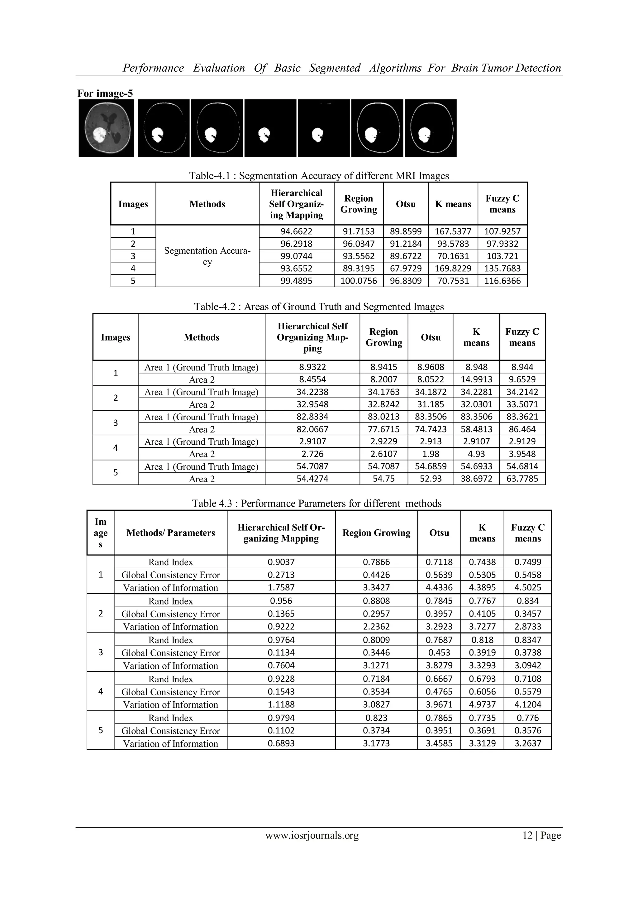 Performance Evaluation of Basic Segmented Algorithms for Brain Tumor Detection | PDF