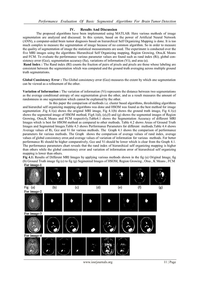 Performance Evaluation of Basic Segmented Algorithms for Brain Tumor Detection | PDF