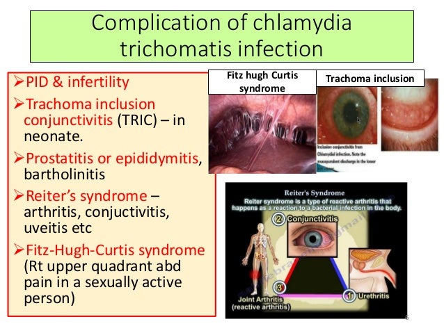 Clinical microbiology : Chlamydia trachomatis an overview of STD's