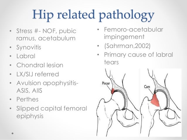 Sporting Hip and Groin IST 2
