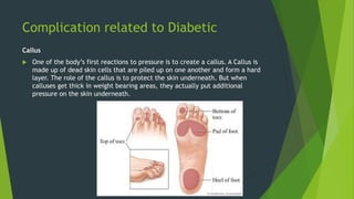 Complications develop in foot related to Diabetic | PPTX