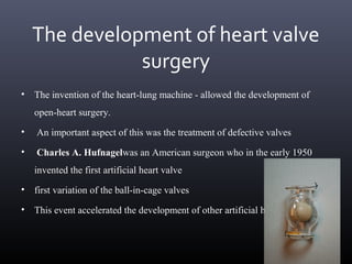 History of cardiac surgery DR NIKUNJ R SHEKHADA (MBBS,MS GEN SURG ,DNB ...