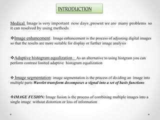 B12. Medical image comparession DWT.pptx