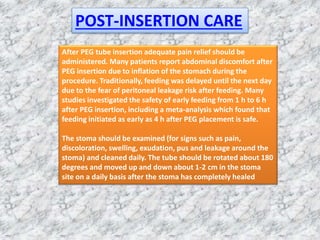 Percutaneous Endoscopic Gastrostomy | PPTX