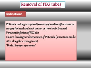 Percutaneous Endoscopic Gastrostomy | PPTX