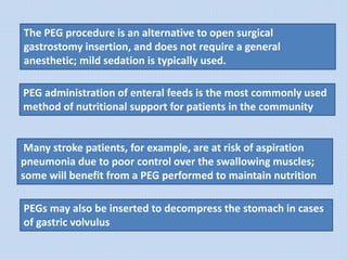 Percutaneous Endoscopic Gastrostomy | PPTX