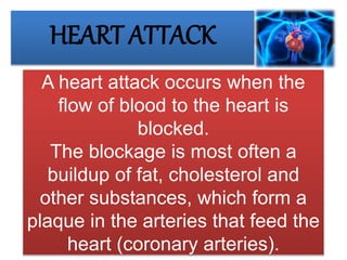 heart attack - medical notes | PPTX
