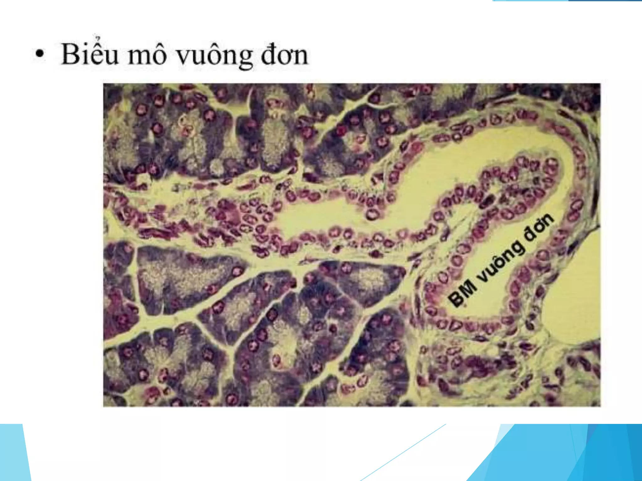 B1 BIEU MO - DHXN.ppt