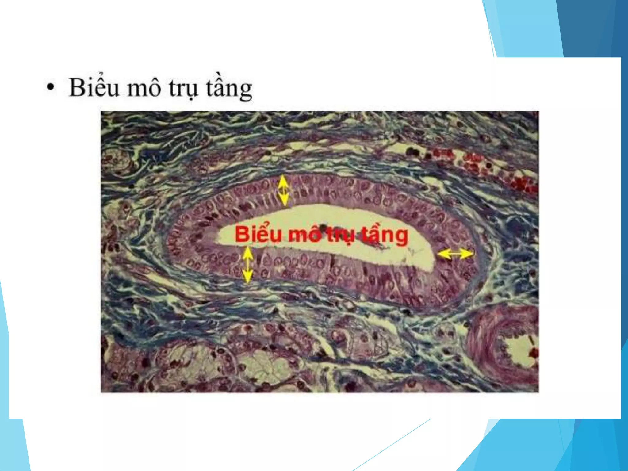 B1 BIEU MO - DHXN.ppt