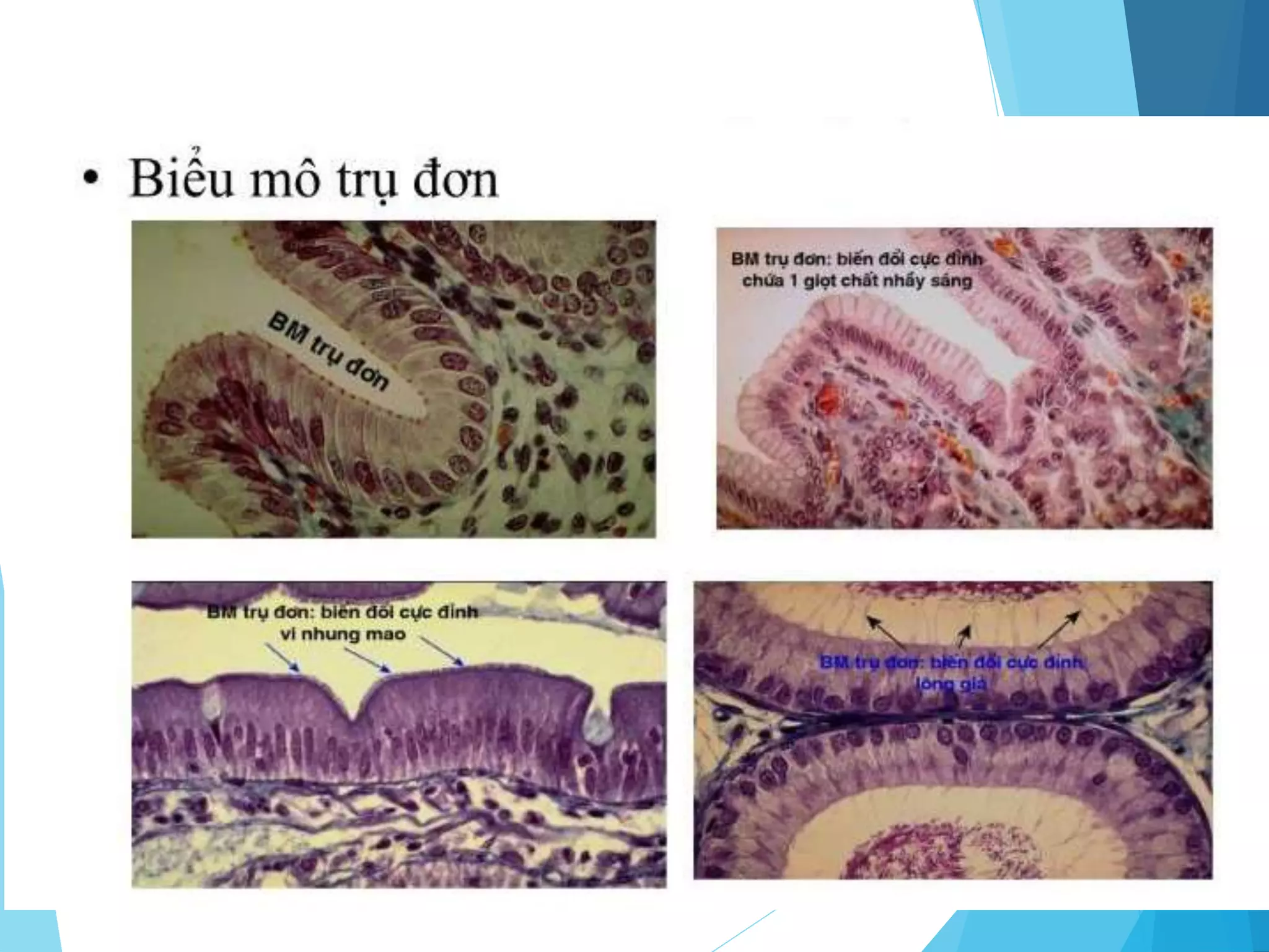 B1 BIEU MO - DHXN.ppt