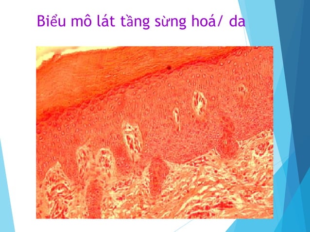 B1 BIEU MO - DHXN.ppt