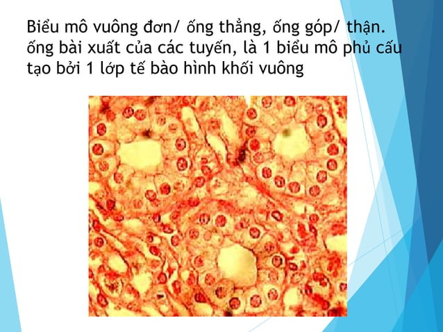 B1 BIEU MO - DHXN.ppt
