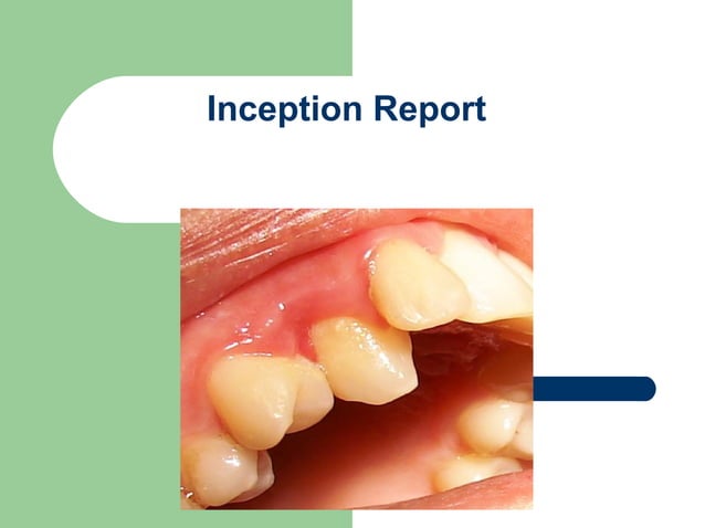 reconstruction of oral inclination of teeth 13, | PPT