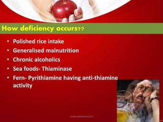 B1 thiamine | PPT