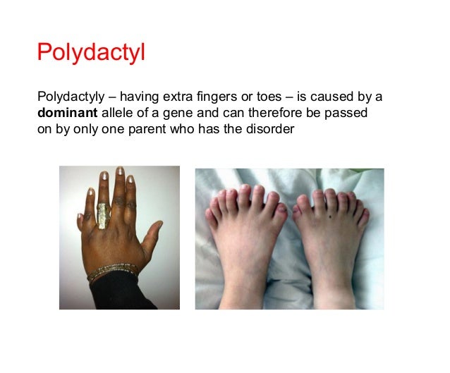 B2.7 genetic disorders