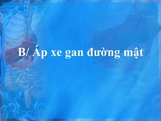 B23 apxe gan | PPT