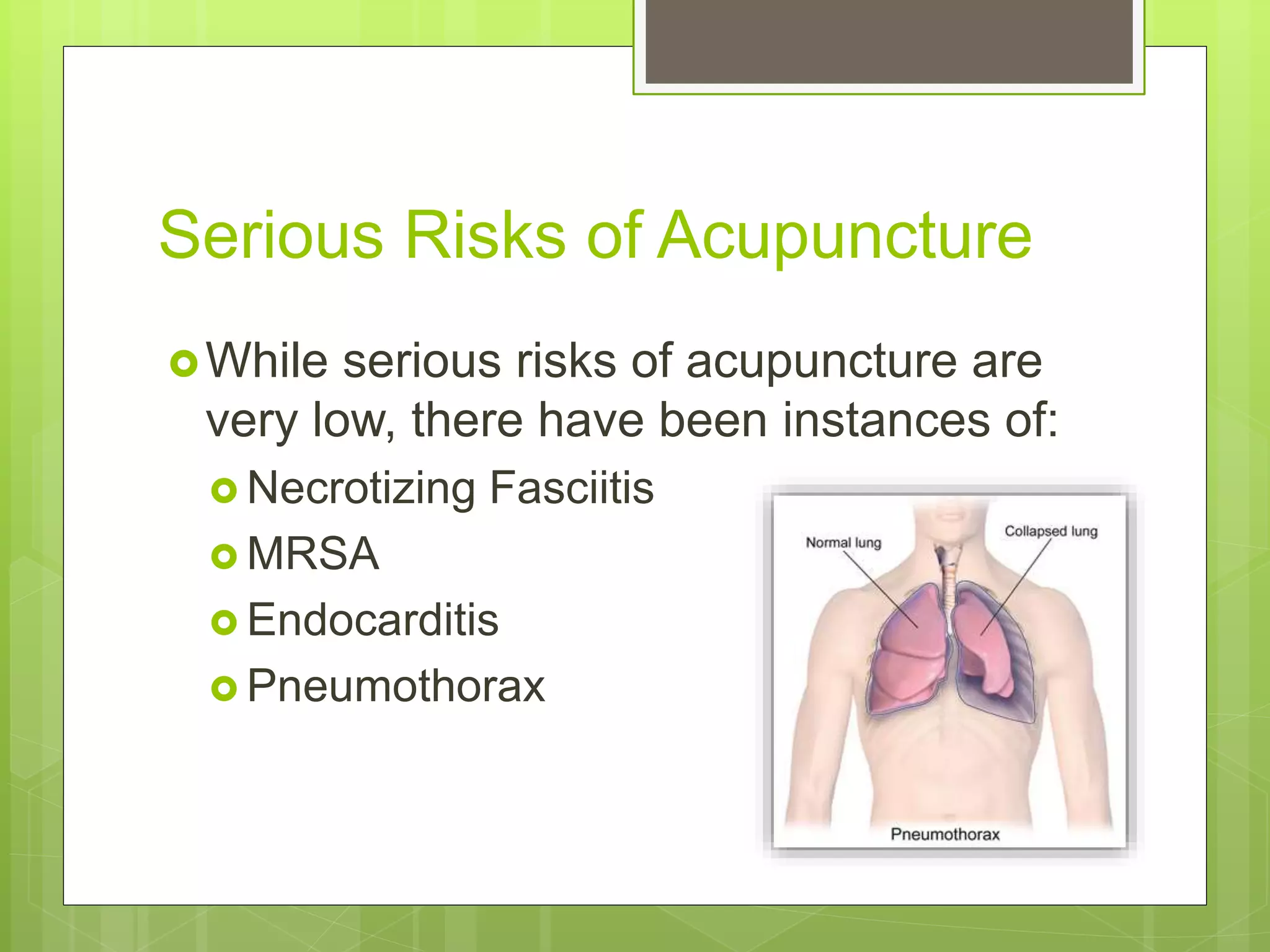 Acupuncture Presentation | PPTX