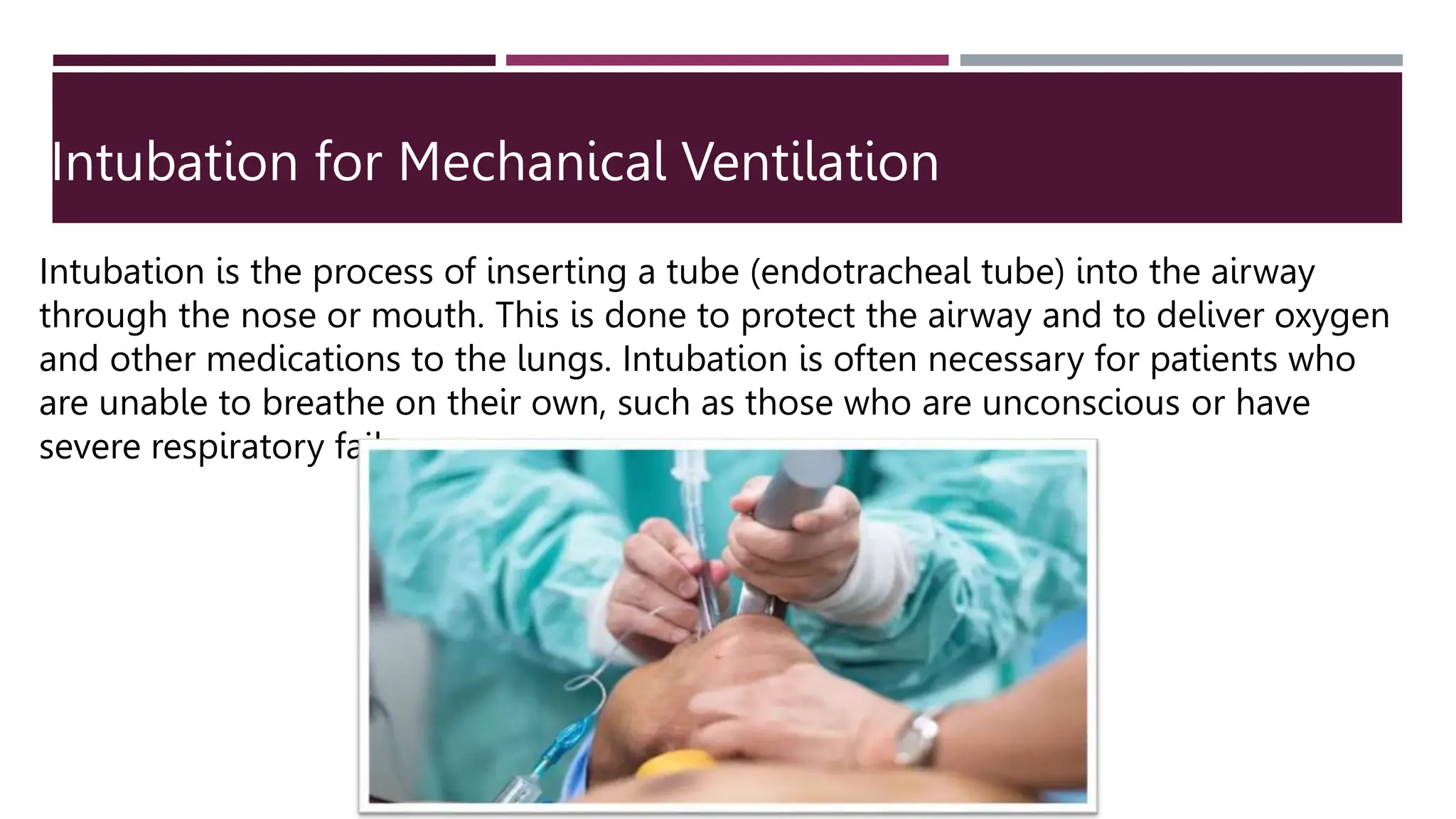 mechanical ventilator | PPTX