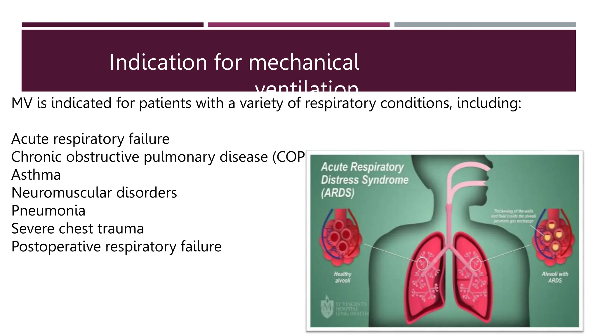mechanical ventilator | PPTX