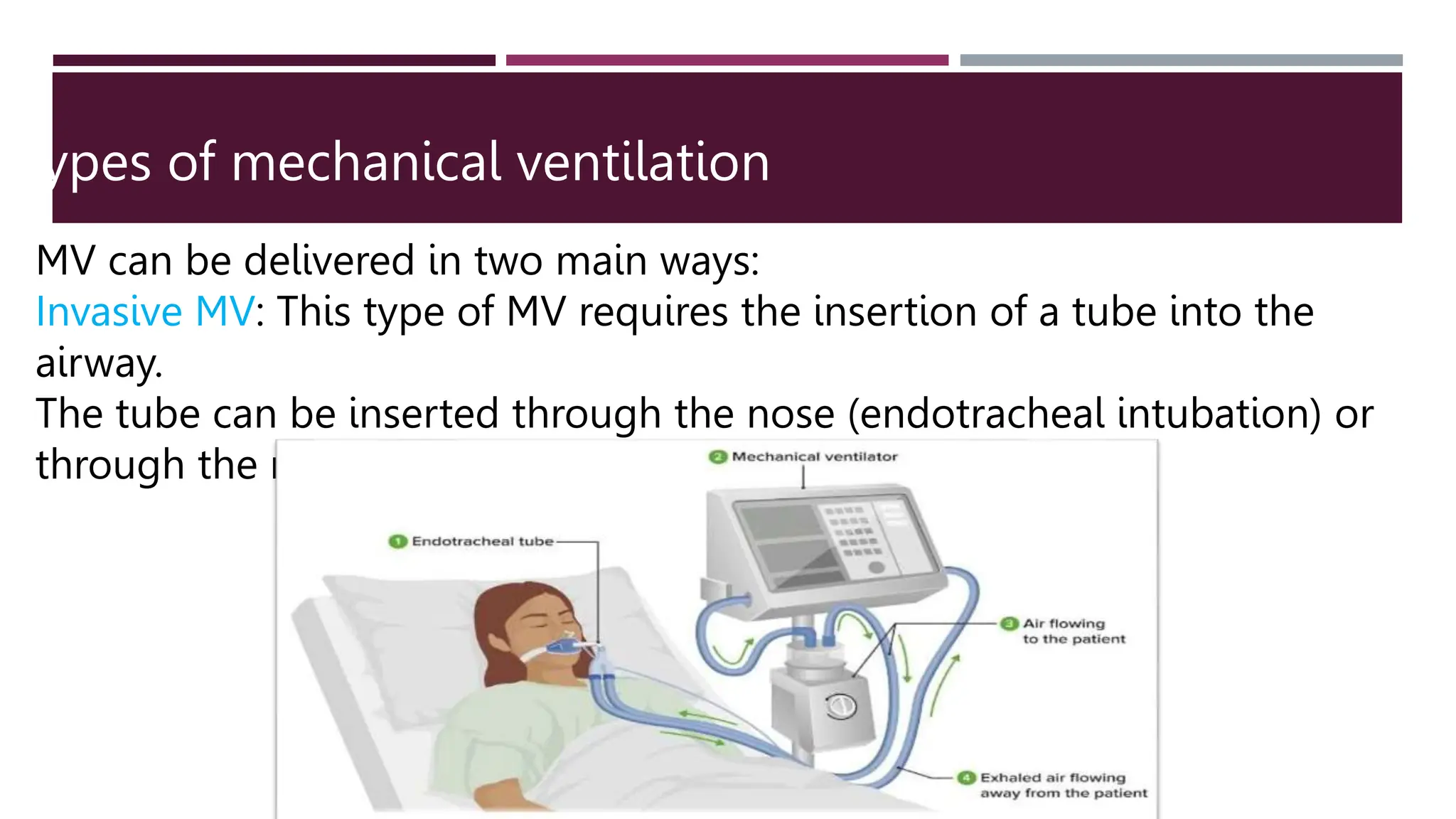 mechanical ventilator | PPTX