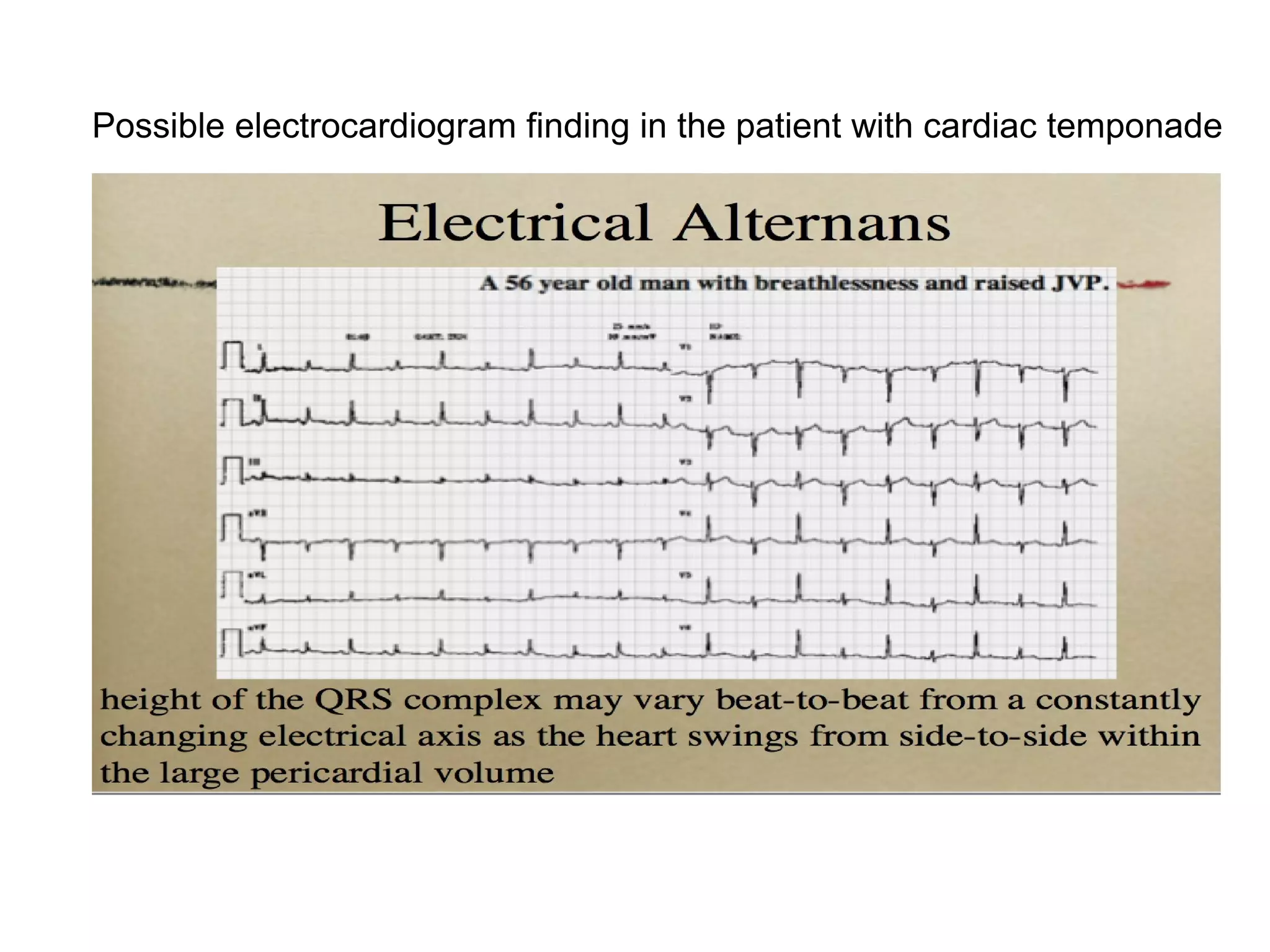 PPM RA lead troubleshooting | PPT