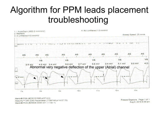 PPM RA lead troubleshooting | PPT