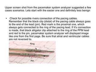 PPM RA lead troubleshooting | PPT