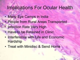 Polymer Use & Ocular DDelivery Modified | PPTX | Eye and Vision ...