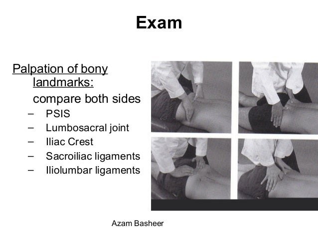 SI joint Fusion Azam Basheer MD