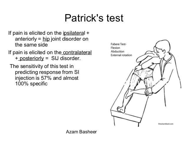 SI joint Fusion Azam Basheer MD