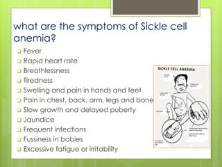 sickle_cell_anemia_presentation-2-converted_-_pulkit_leuva.pdf | Blood ...