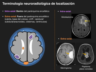 SESION_13_-_Neuroradiologia.pdf