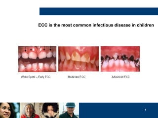 Children’s OralHealth Initiative (COHI) Overview | PPT