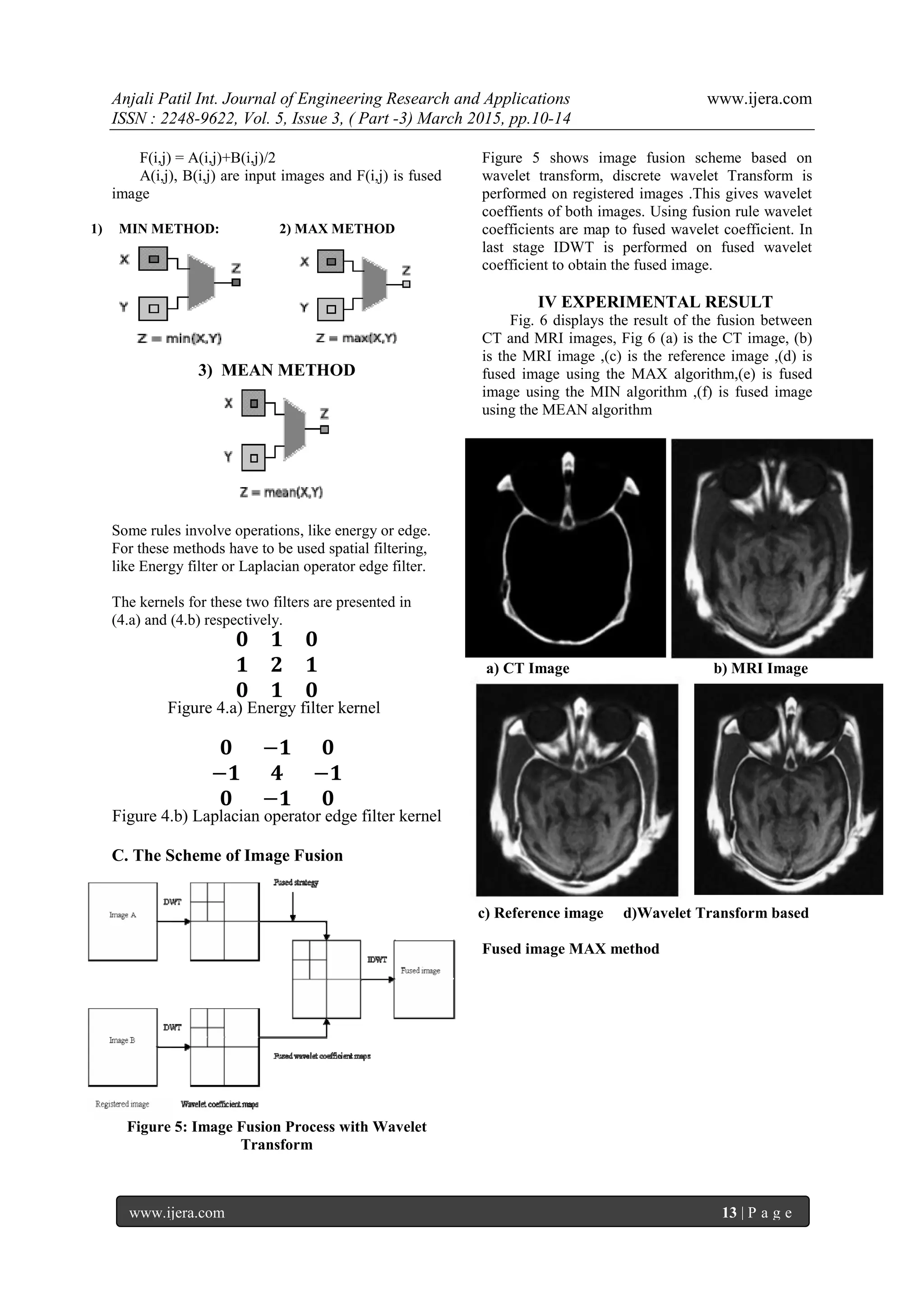 Wavelet Transform based Medical Image Fusion With different fusion ...