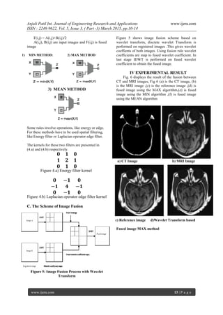 Wavelet Transform based Medical Image Fusion With different fusion ...