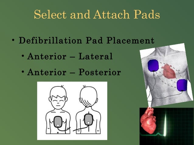AED Presentation 01-03-17 | PPT | First Aid | Injuries