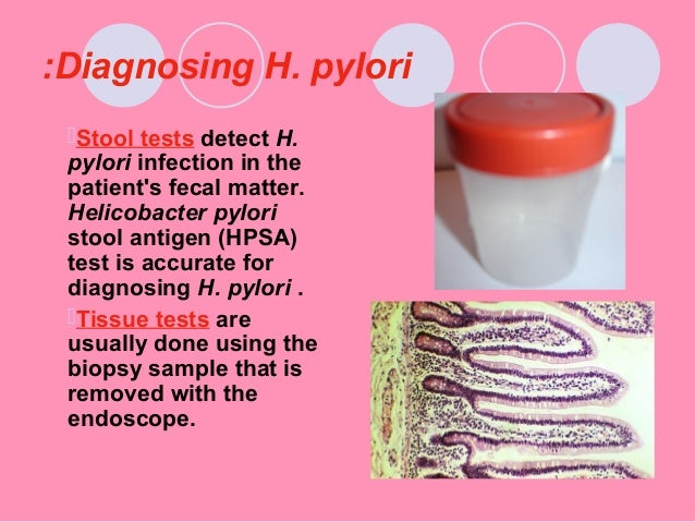 peptic ulcer disease.PPT