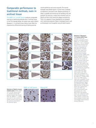 SNAP 2 Brochure | PDF