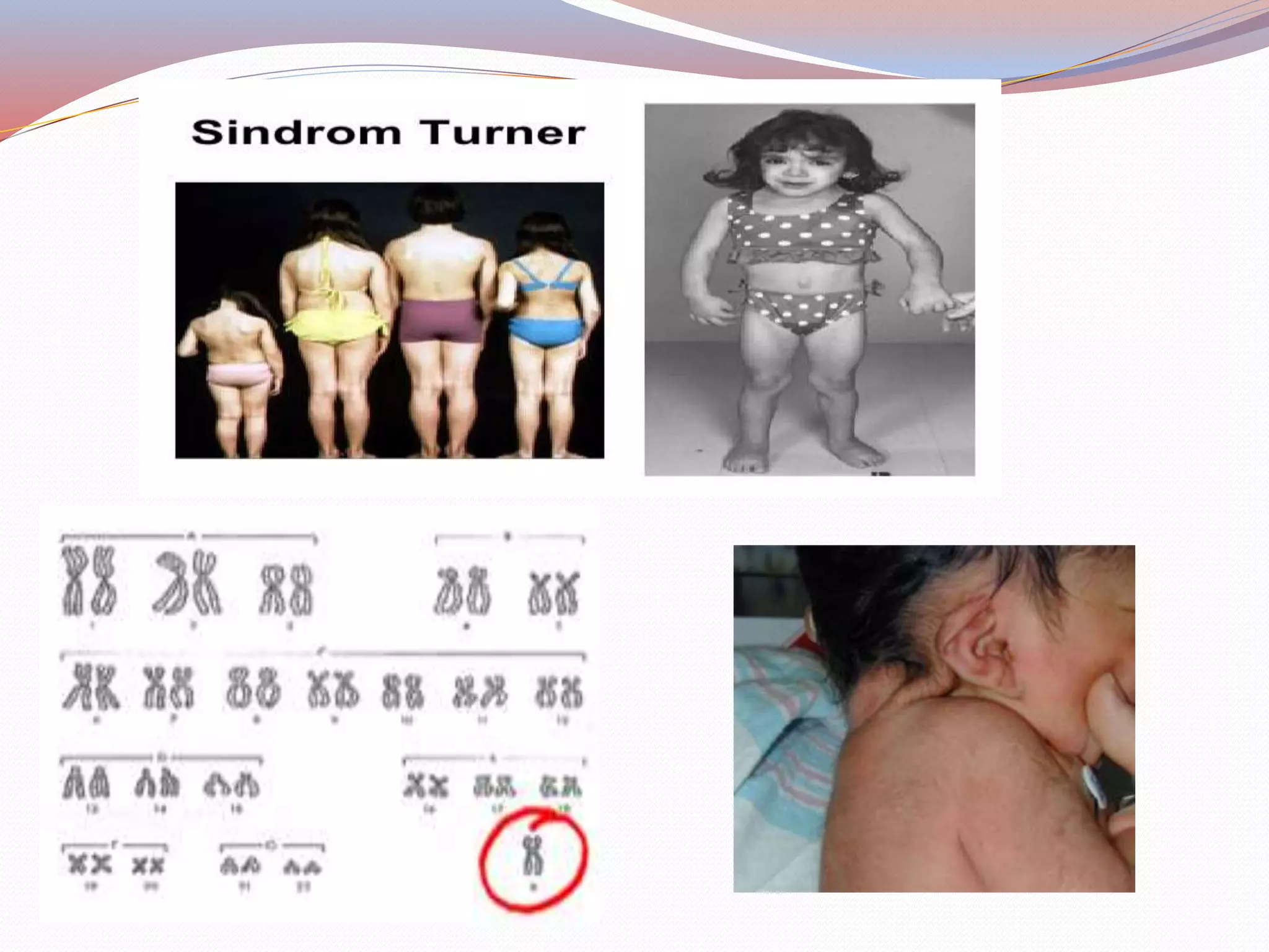 Bab 5 : Genetik (Sains KSSM Ting. 4) | PPTX