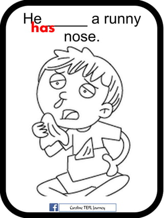 Nasal Catarrh Coloring Pages