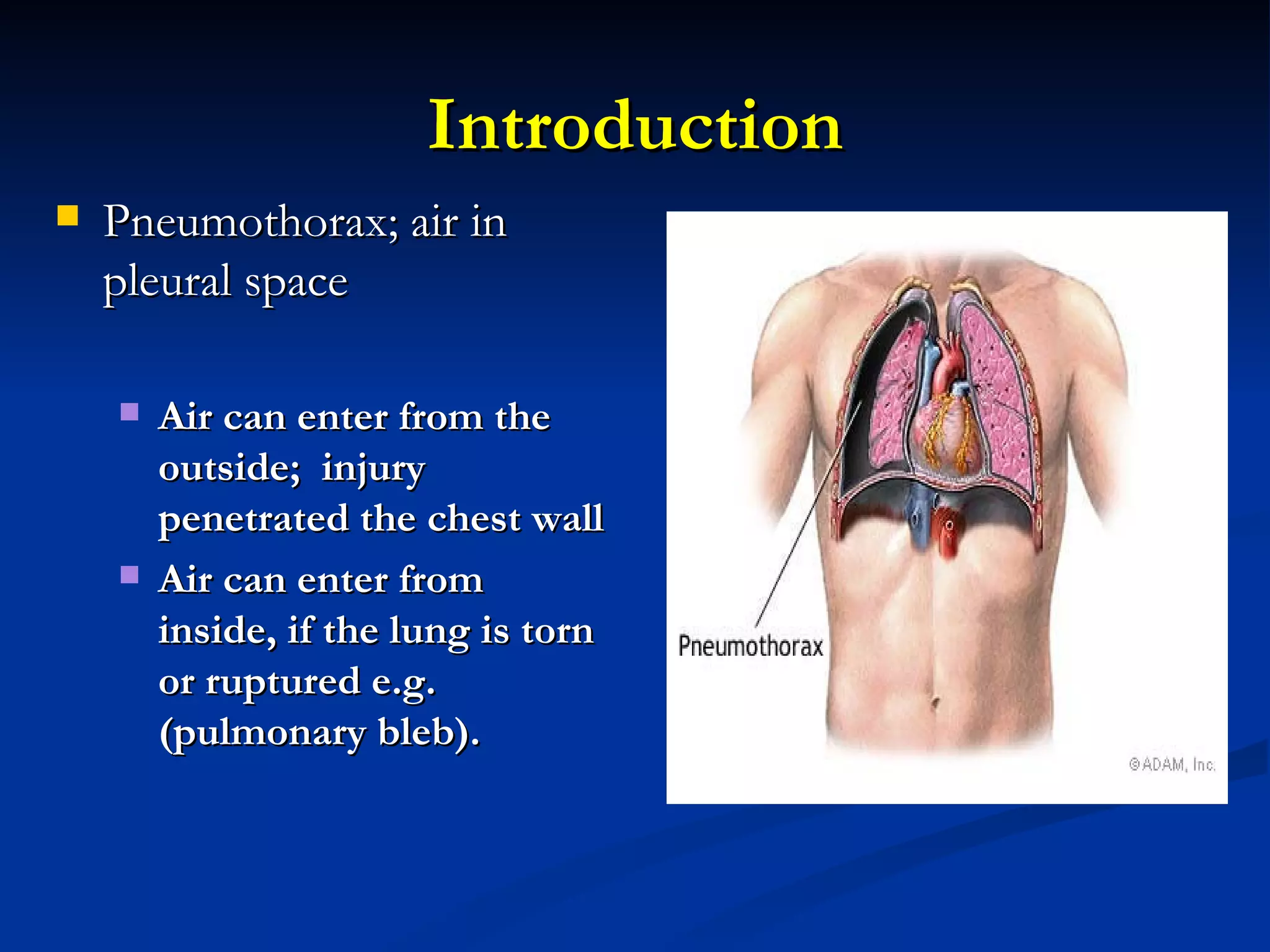 pneumothorax in ICU | PPT