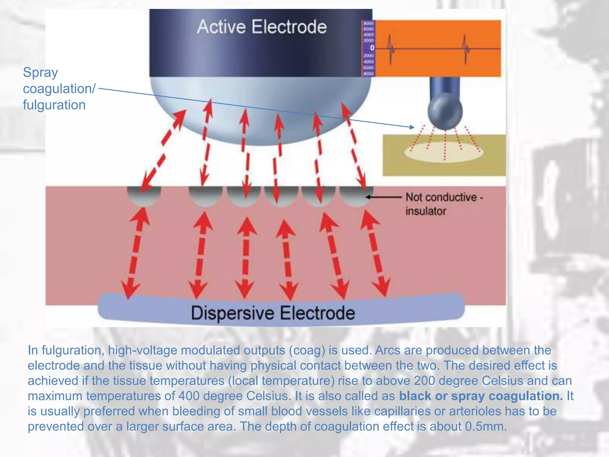 basics of electrosuregery | PPTX
