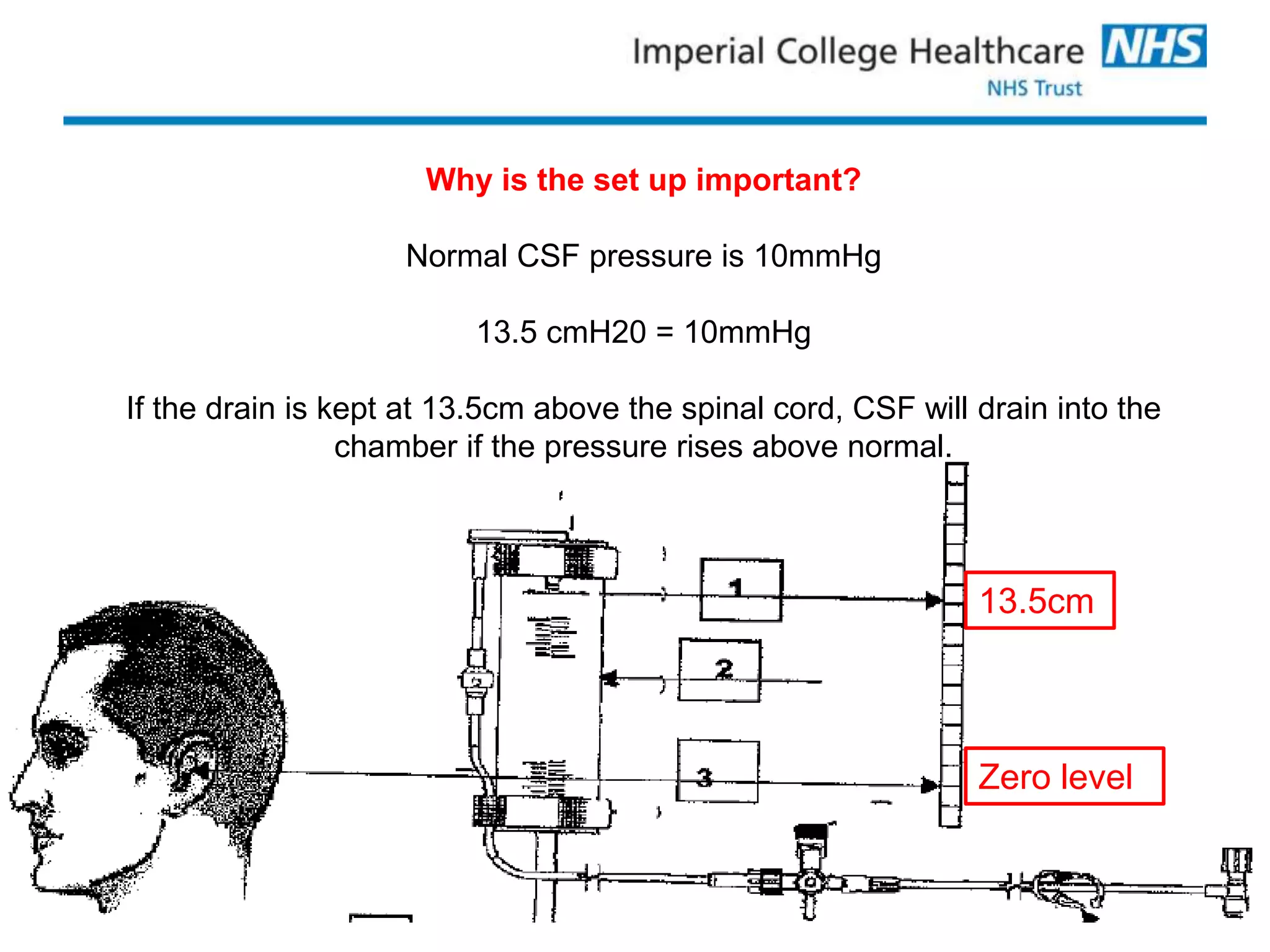 Spinal drain post-op management 2 | PPTX