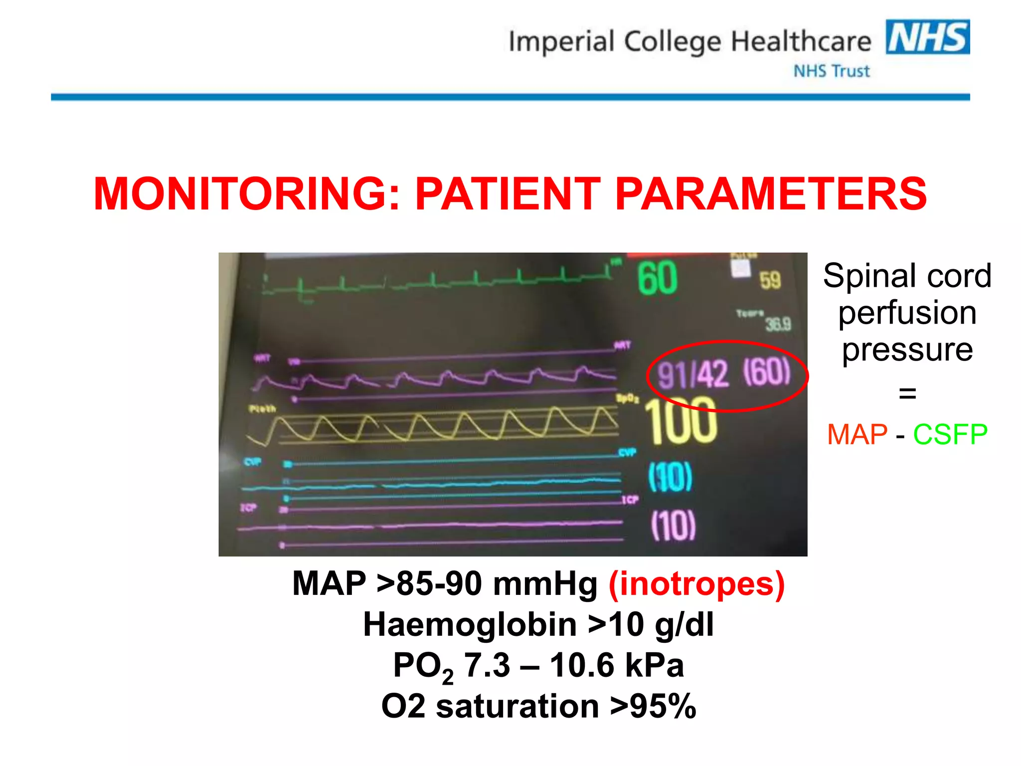 Spinal drain post-op management 2 | PPTX