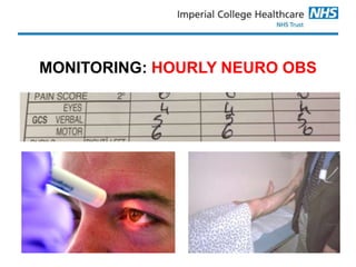 Spinal drain post-op management 2 | PPTX